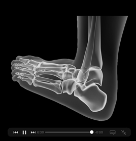 Forefoot Reconstruction Surgery Frisco | Arthroscopic Surgery McKinney ...